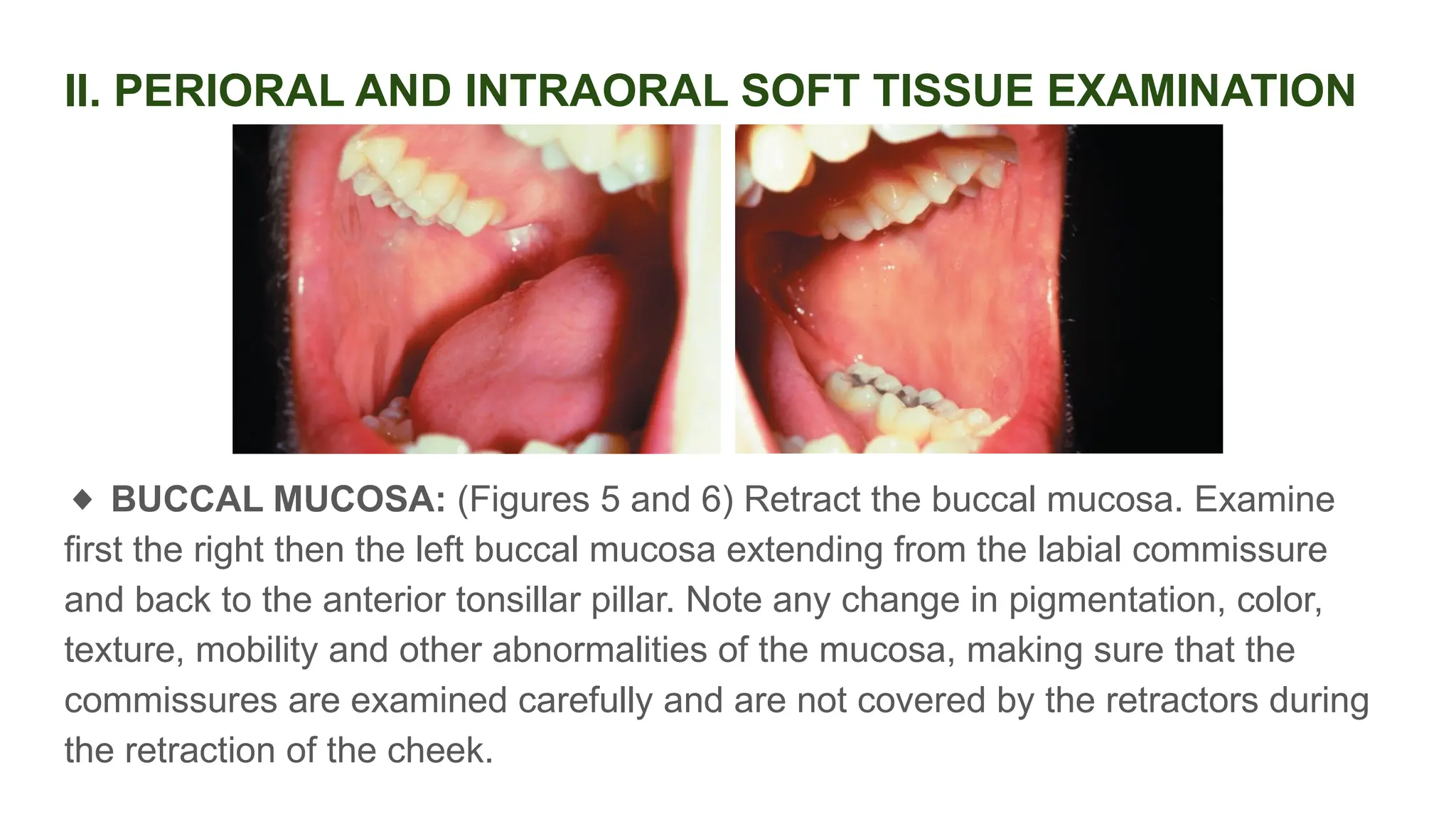 Oral Cancer and its tissue changes signs | PPTX