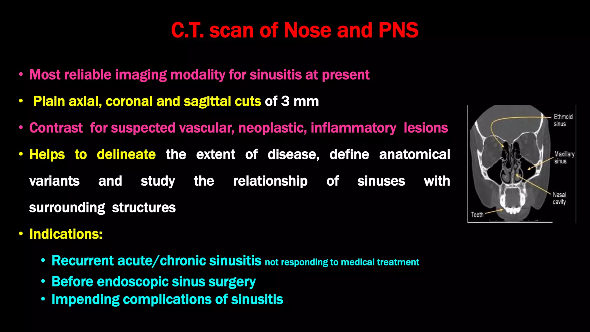 Clinical features and diagnosis of rhinosinusitis | PPTX