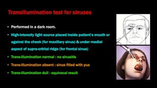 Clinical features and diagnosis of rhinosinusitis | PPTX