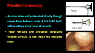 Clinical features and diagnosis of rhinosinusitis | PPTX