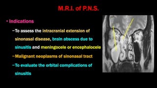 Clinical features and diagnosis of rhinosinusitis | PPT