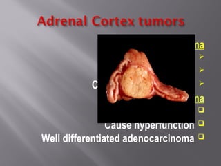 6 The Adrenal gland pathology lecture.ppt