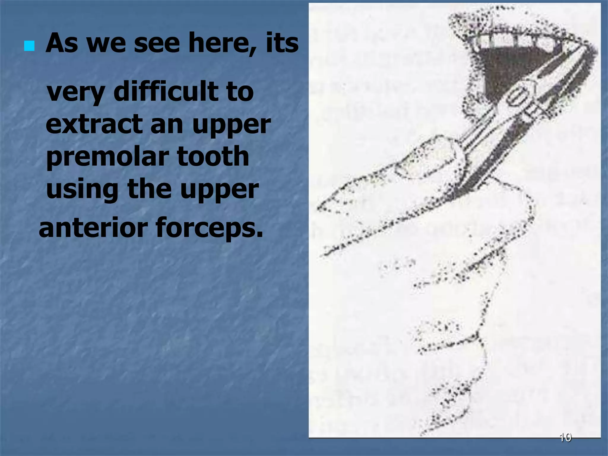 Instrumentations of dental extraction and oral surgery | PPT