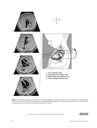 AIUM Practice Guideline for the Performance of Fetal Echocardiography ...