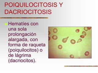 6 alteraciones de hematies | PDF