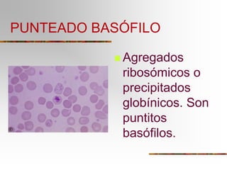 6 alteraciones de hematies | PDF
