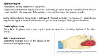 abdominal solid organ injuries | PPTX