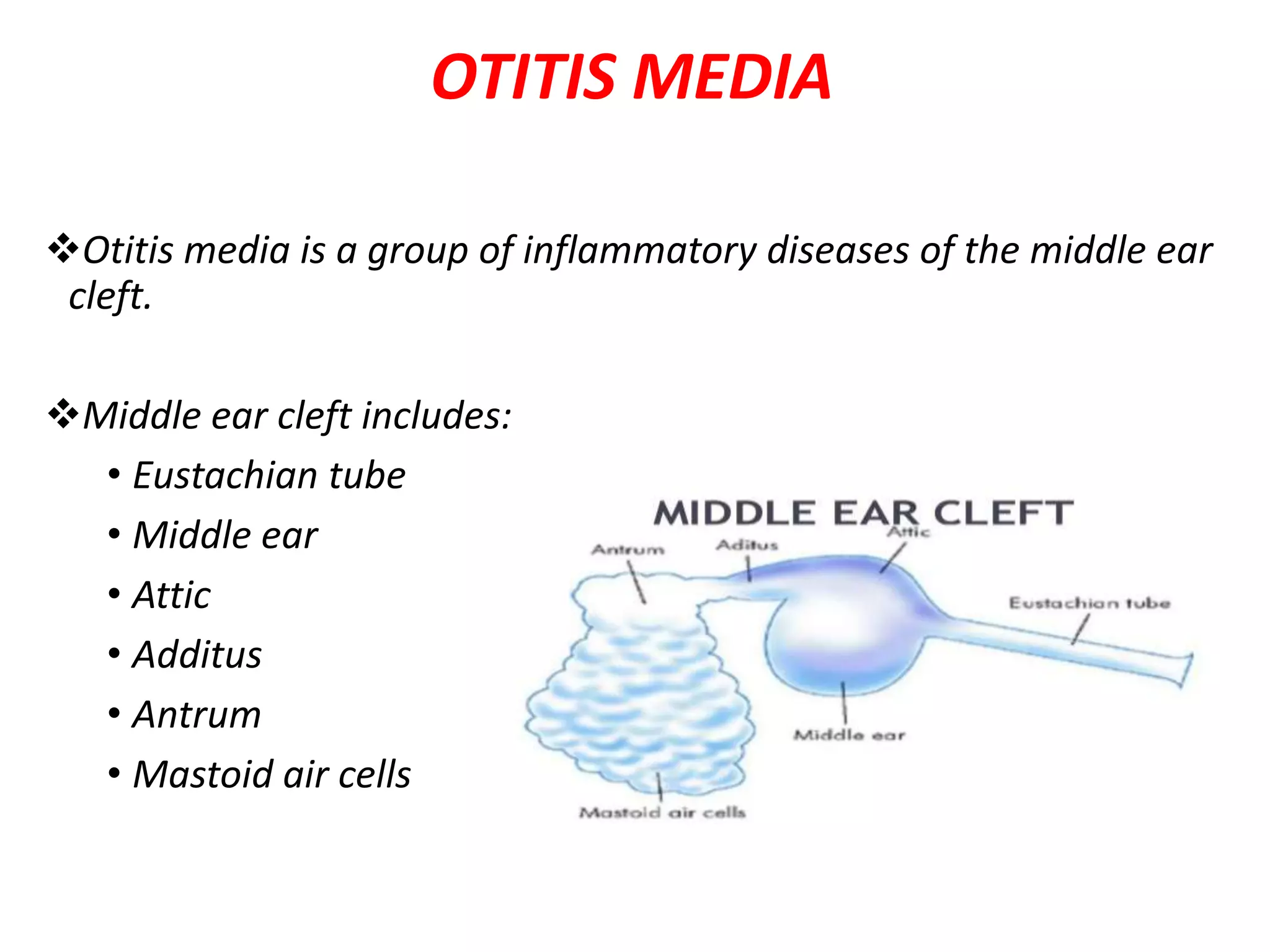 ACUTE SUPPURATIVE OTITIS MEDIA | PPTX