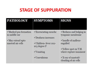 ACUTE SUPPURATIVE OTITIS MEDIA | PPTX