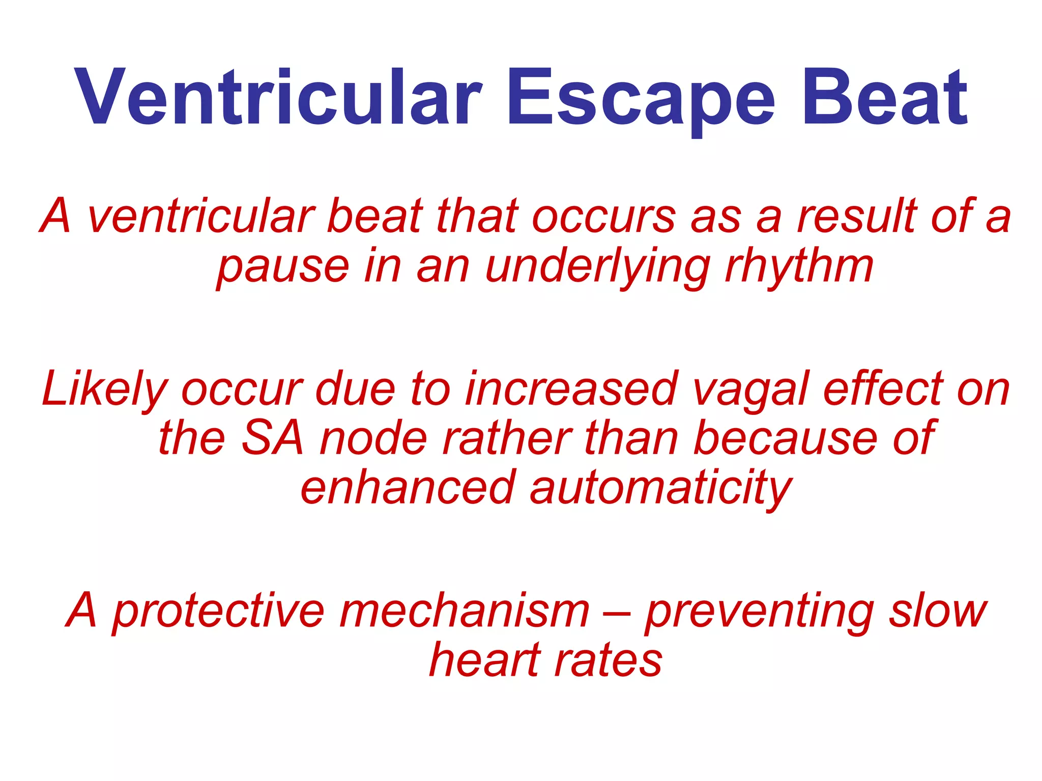 Ventricular Rhythms - BMH/Tele | PPT