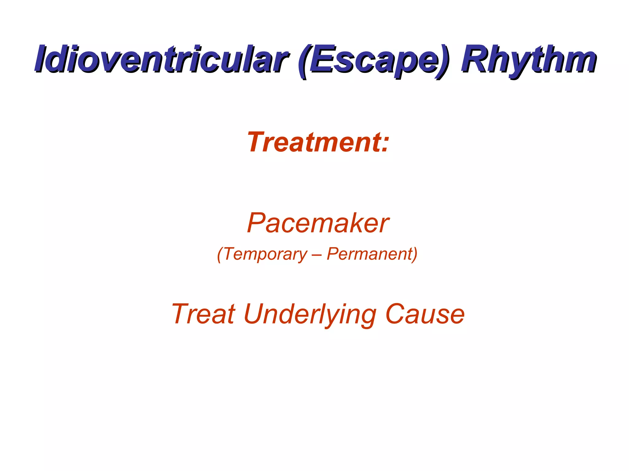 Ventricular Rhythms - BMH/Tele | PPT