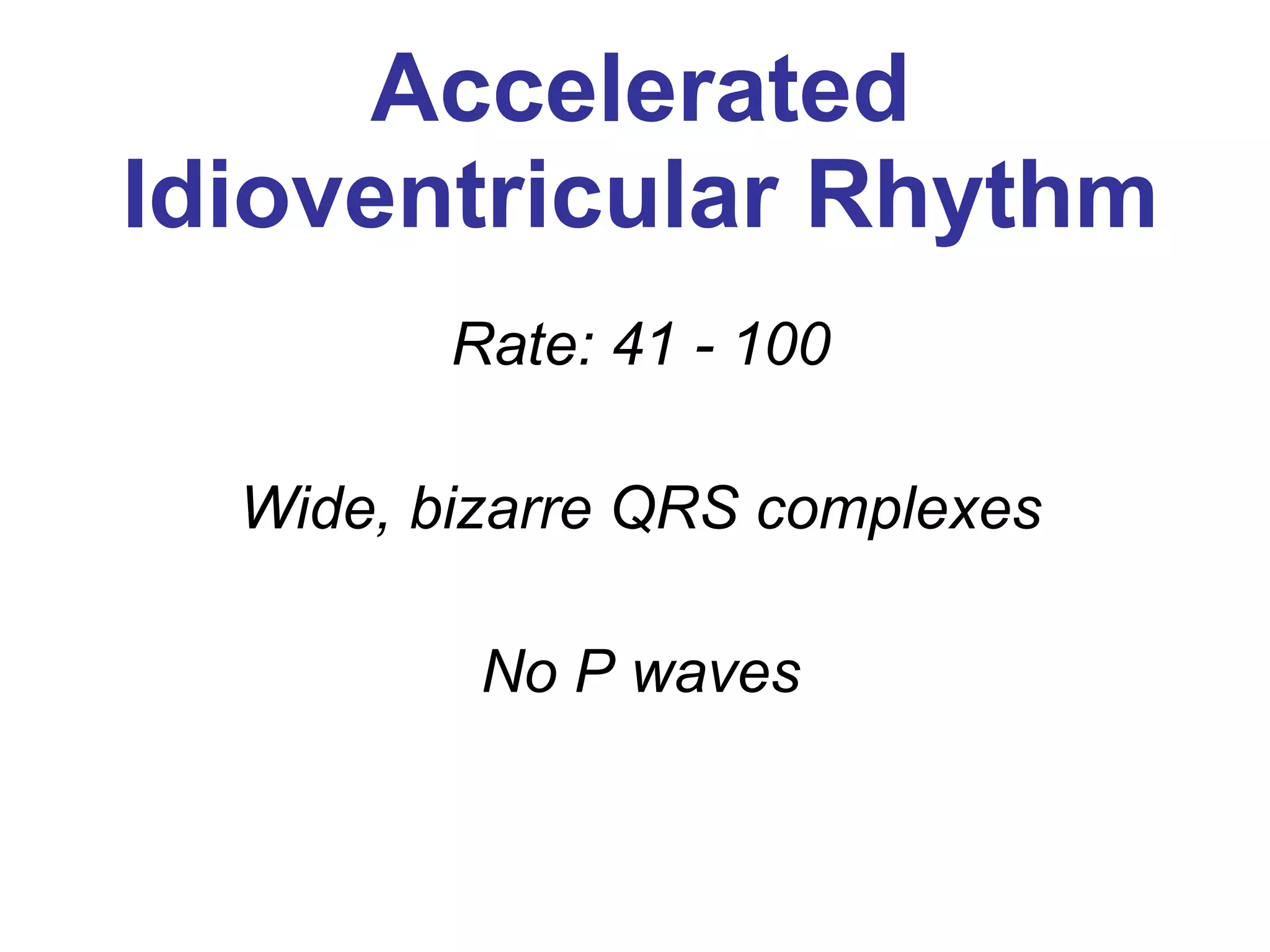 Ventricular Rhythms - BMH/Tele | PPT