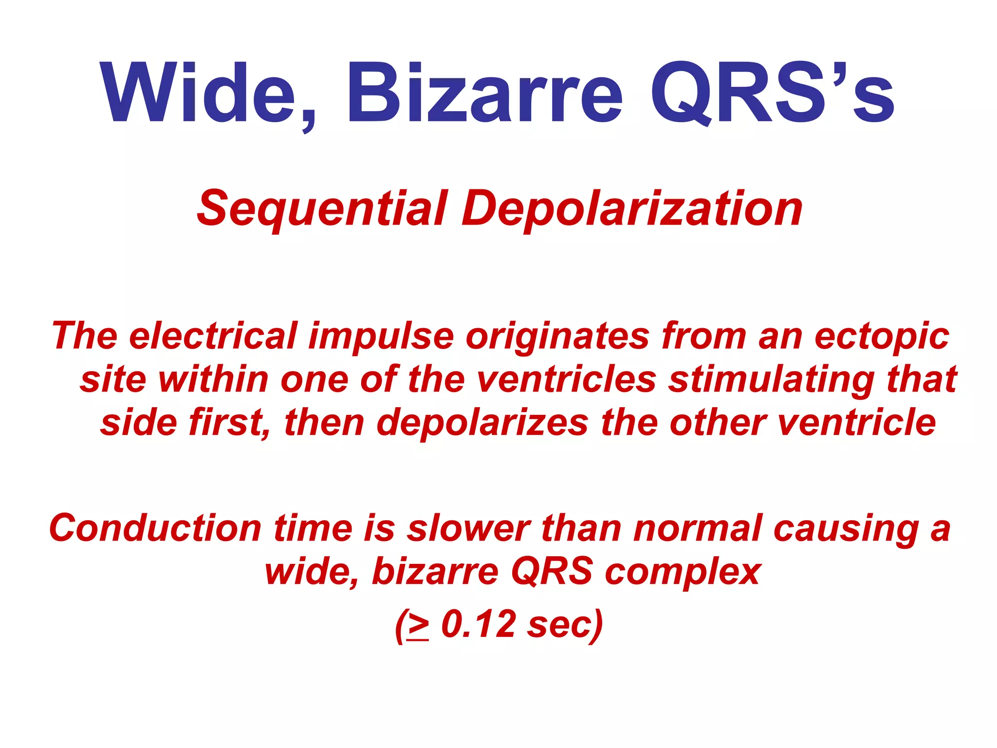 Ventricular Rhythms - BMH/Tele | PPT