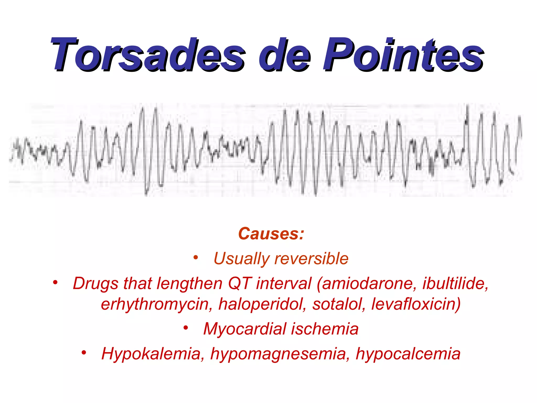 Ventricular Rhythms - BMH/Tele | PPT
