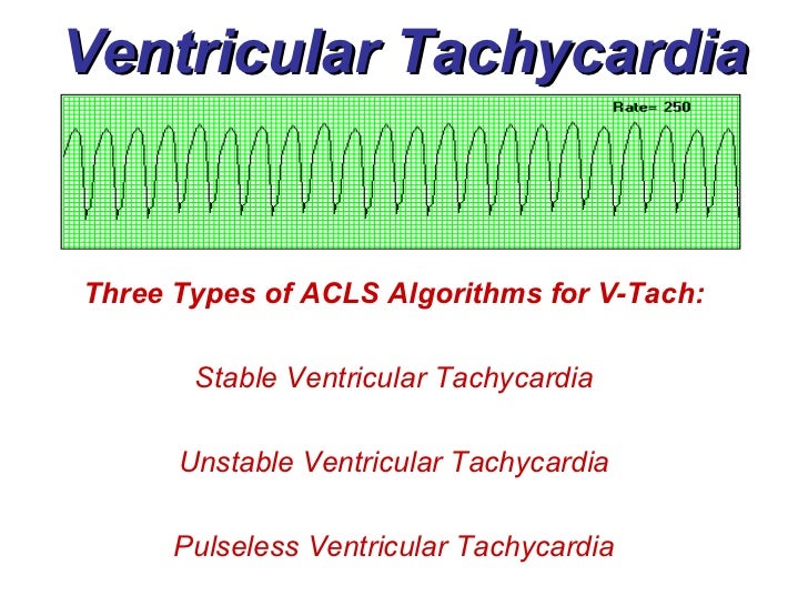 Ventricular Rhythms - BMH/Tele