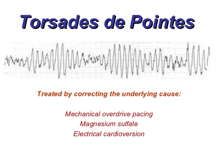 Ventricular Rhythms - BMH/Tele