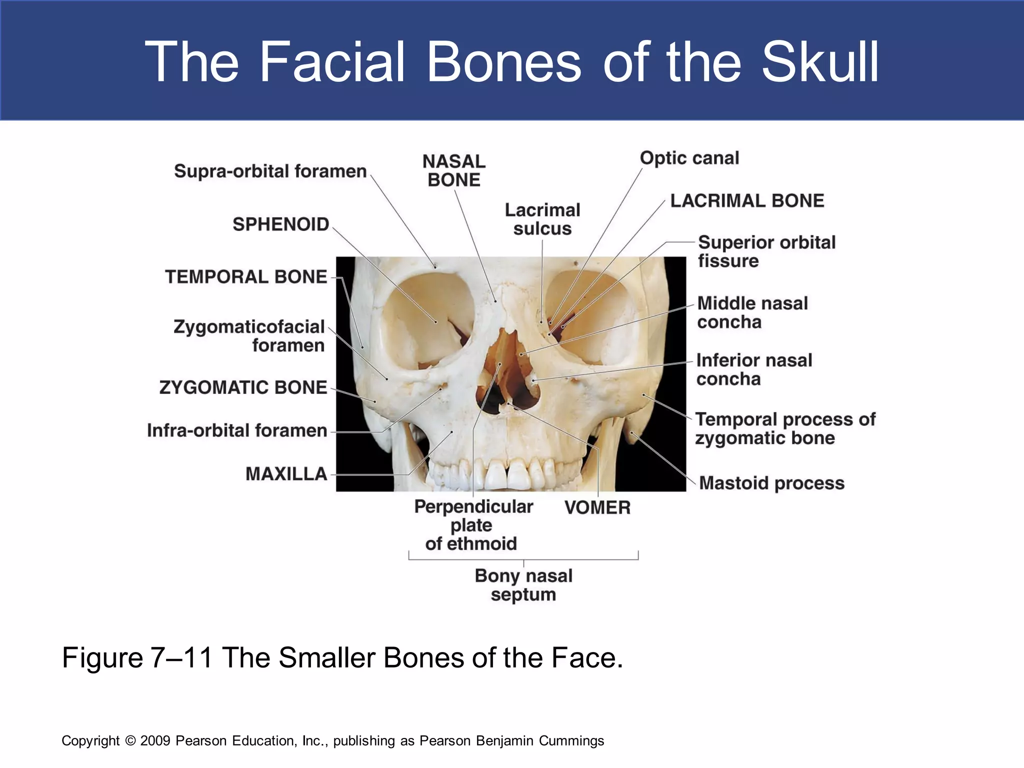 Facial bones anatomy, Anatomic position of fascial bone, axial skeleton ...