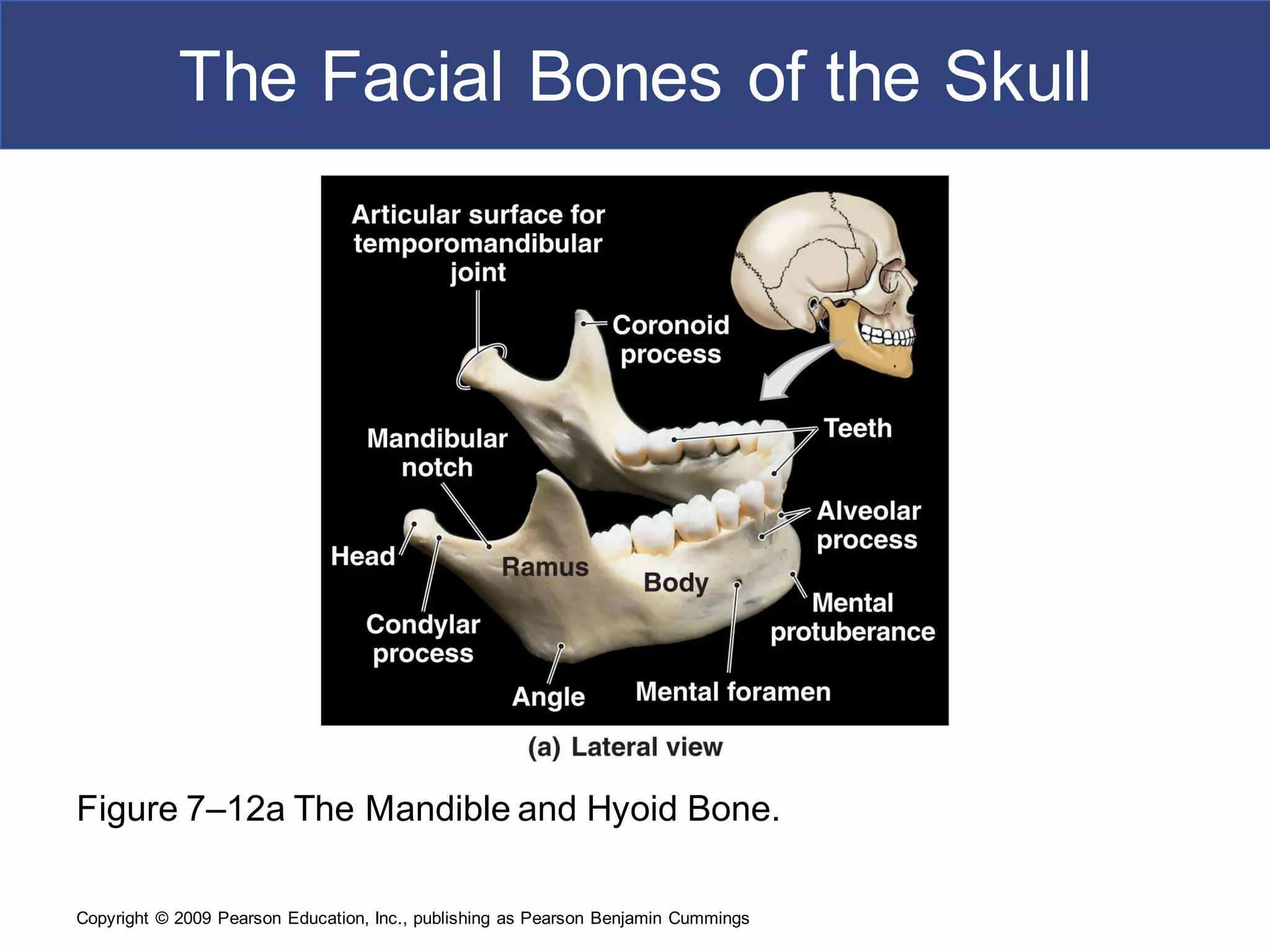 Facial bones anatomy, Anatomic position of fascial bone, axial skeleton ...