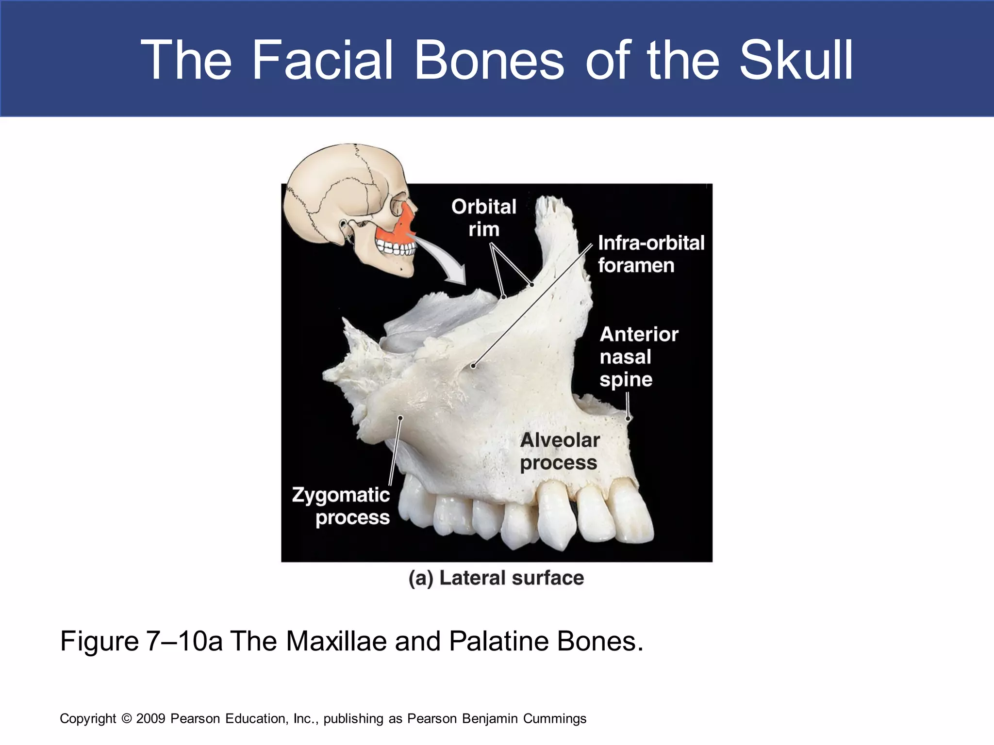 Facial bones anatomy, Anatomic position of fascial bone, axial skeleton ...