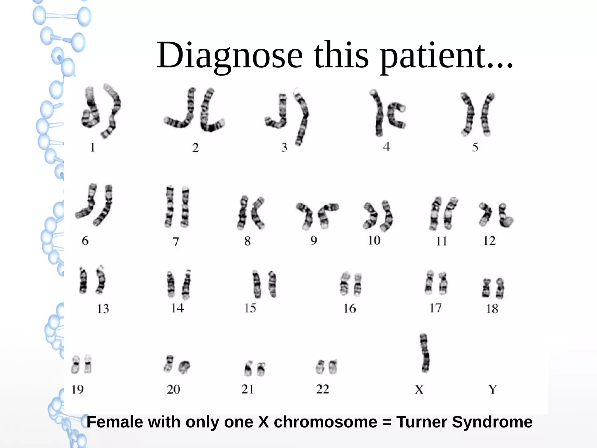 6b chromosome mutations | ODP | Reproductive Health | Diseases and Conditions