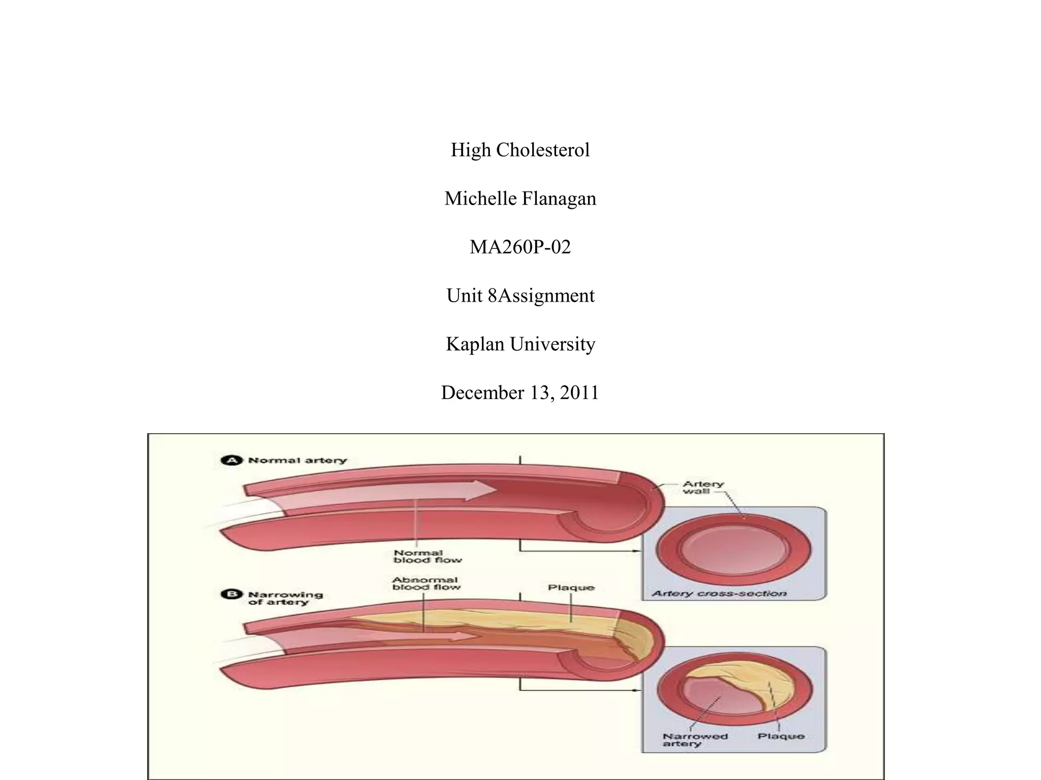 High Cholesterol power point show | PPT
