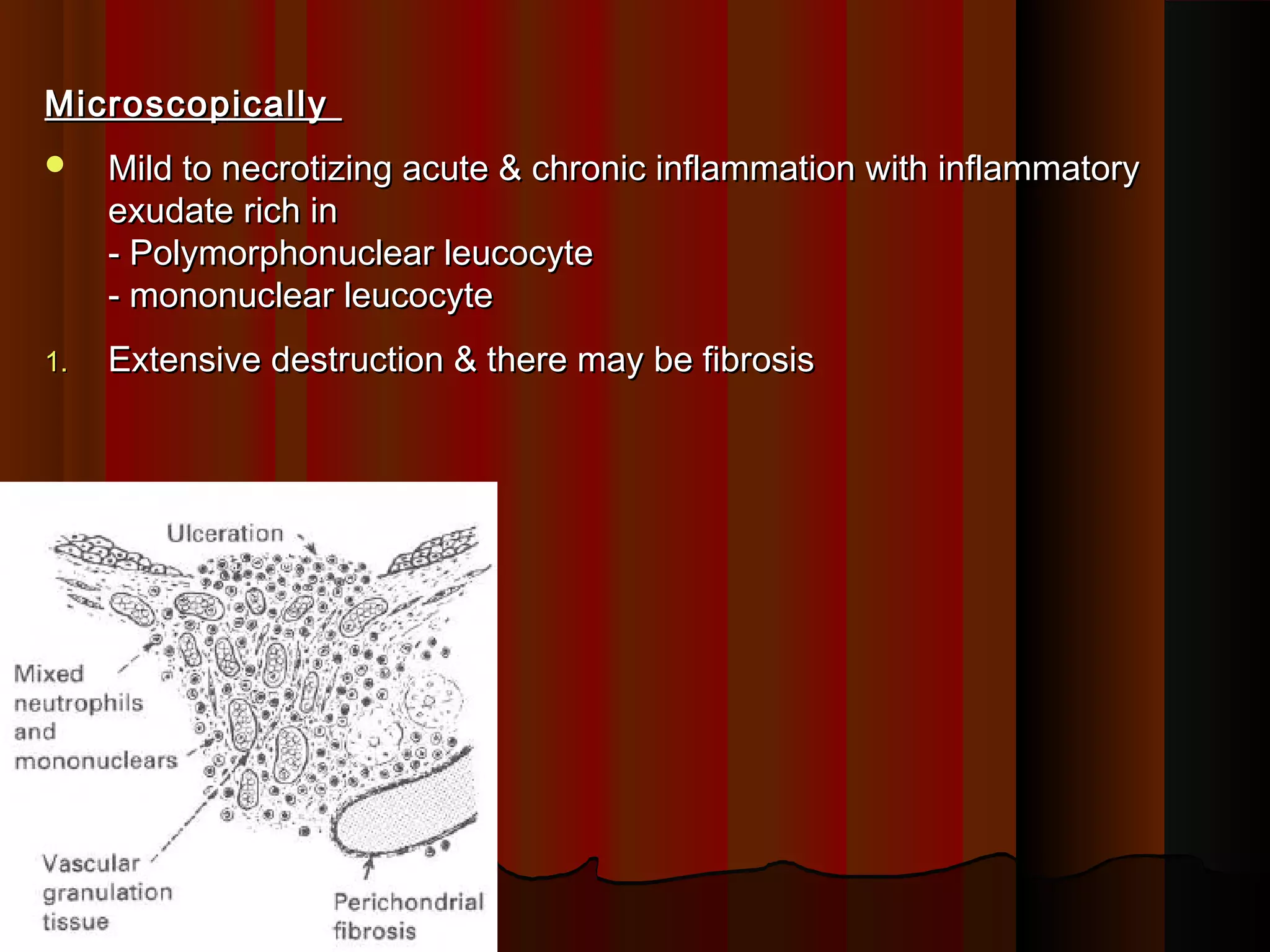 6 bronchiectasis | PPT