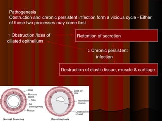 6 bronchiectasis | PPT