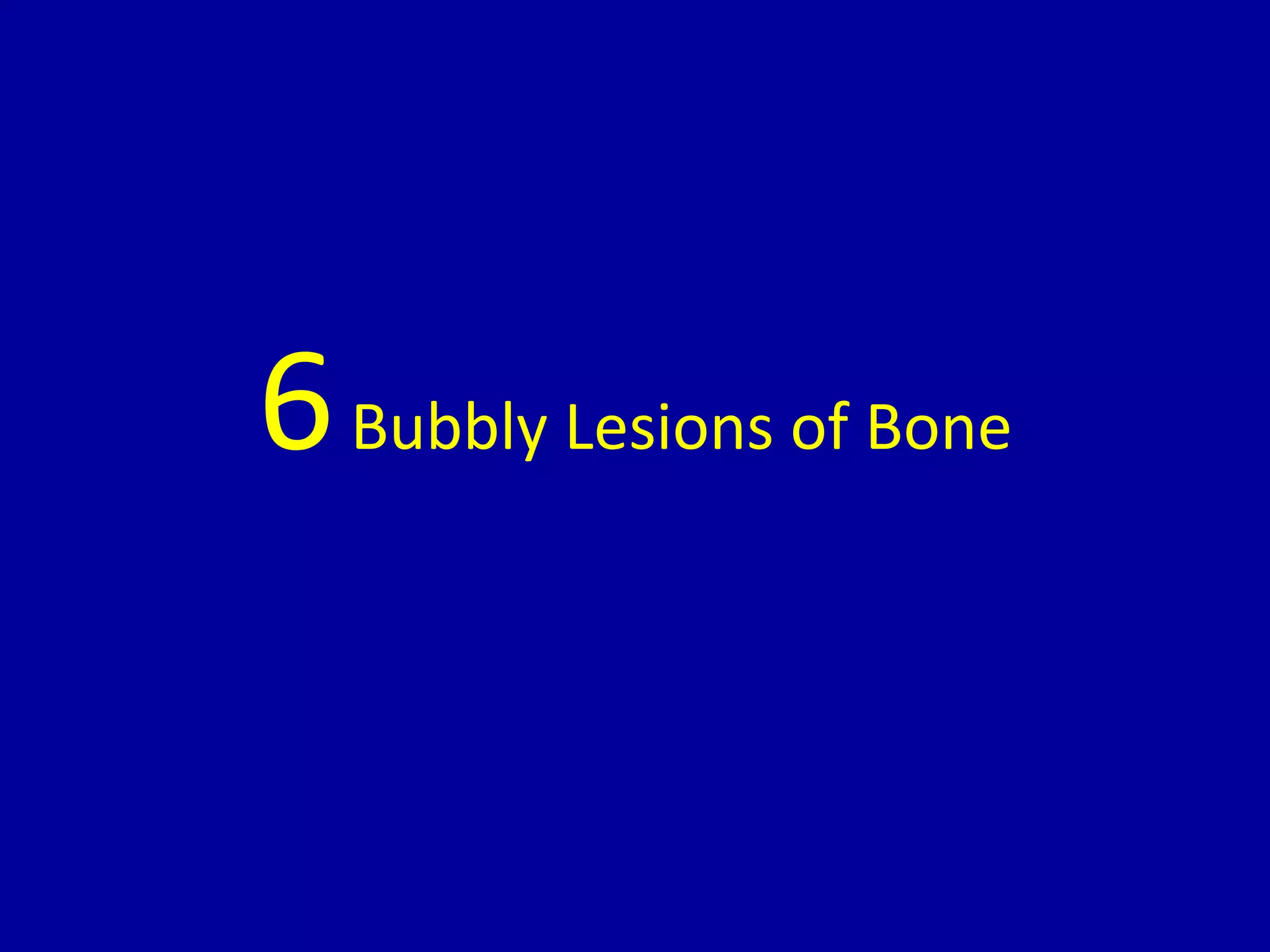 6 bubbly lesions of bone | PPTX