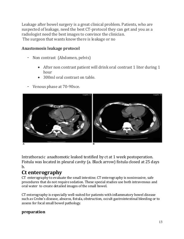 ct_contrast_protocol_and_abdomen_protocol PDF