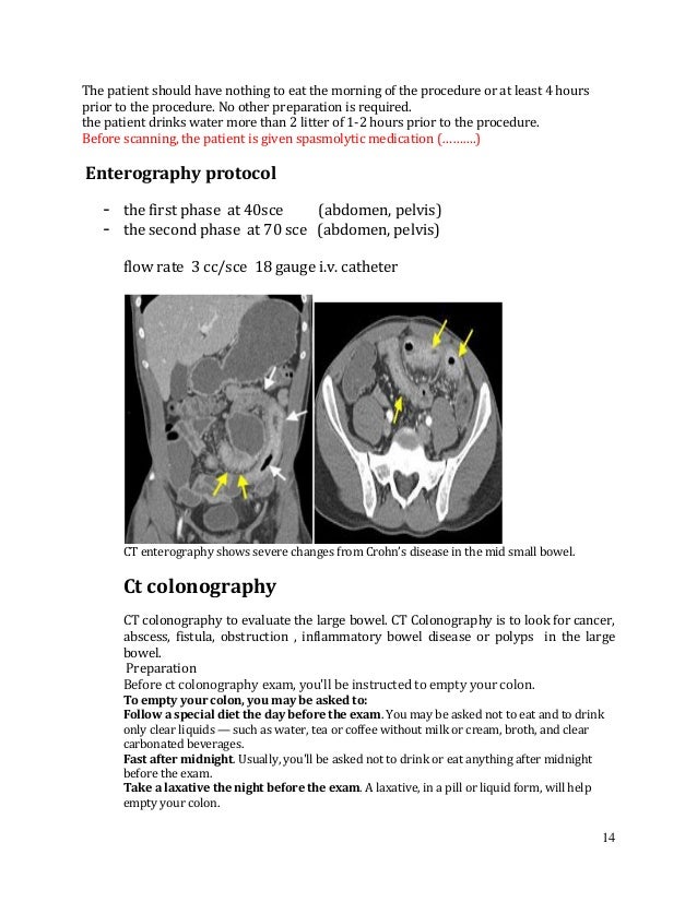 ct_contrast_protocol_and_abdomen_protocol PDF