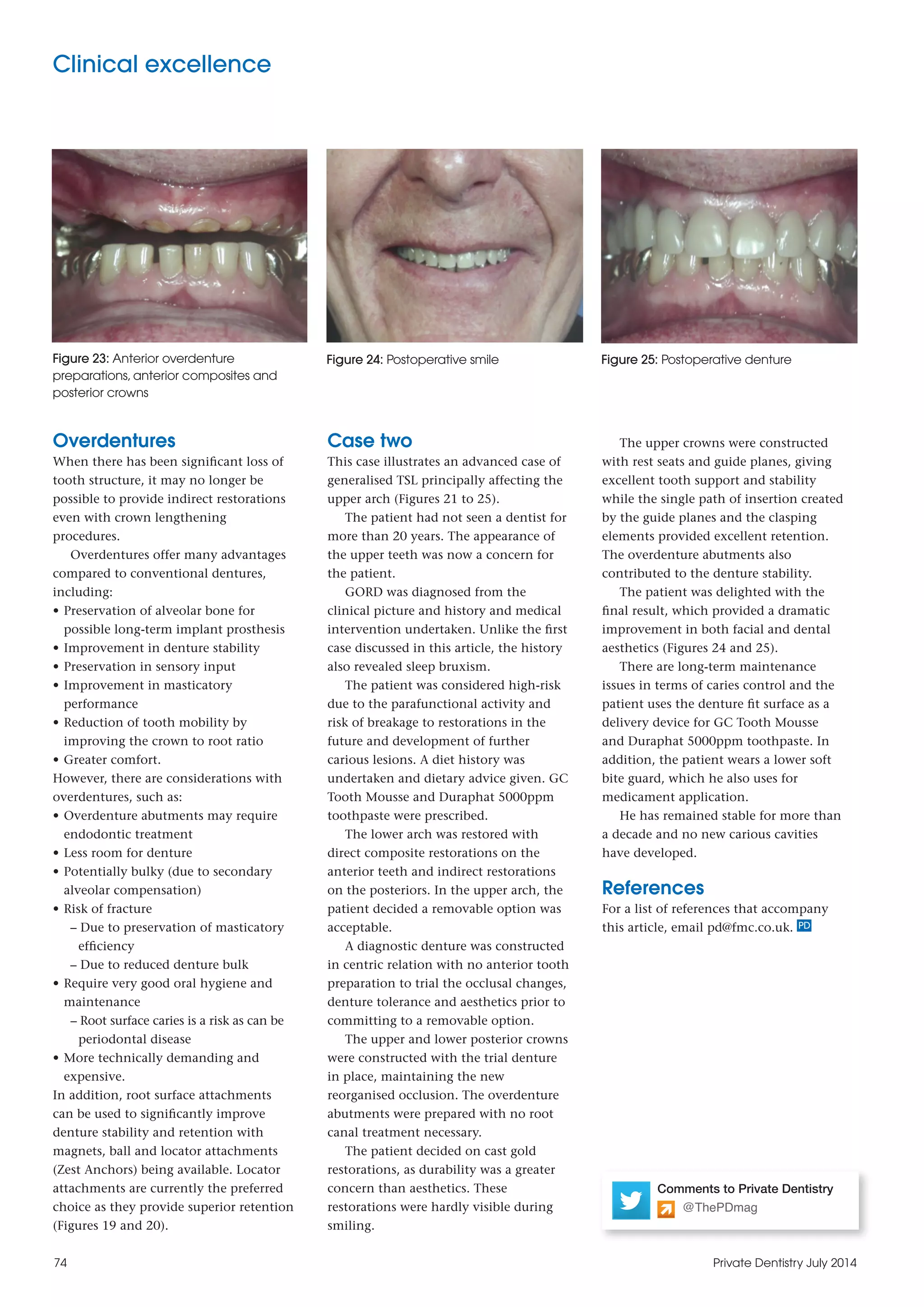 ToothSurfaceLoss_Part2 | PDF