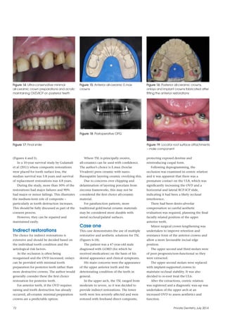 ToothSurfaceLoss_Part2 | PDF