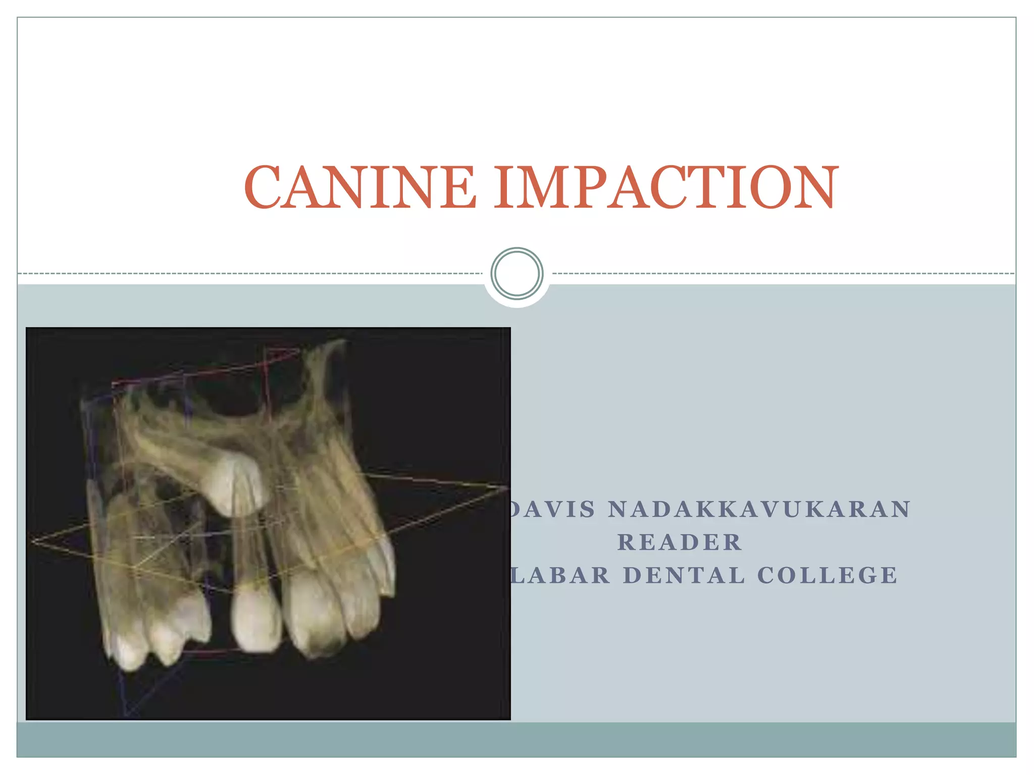 6 canine impaction .pptx