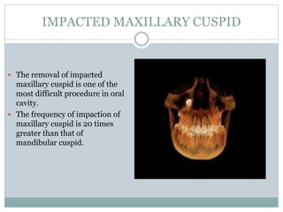 6 canine impaction .pptx