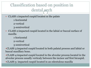6 canine impaction .pptx