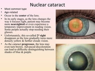 6cataract-170310120227.pdf