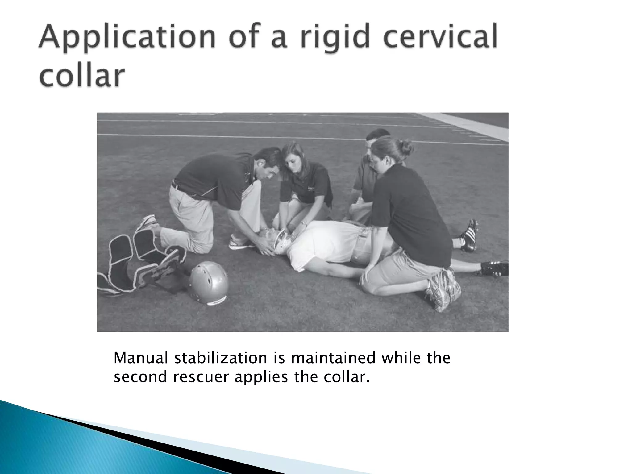 Chapter 6 cervical spine injuries | PPTX