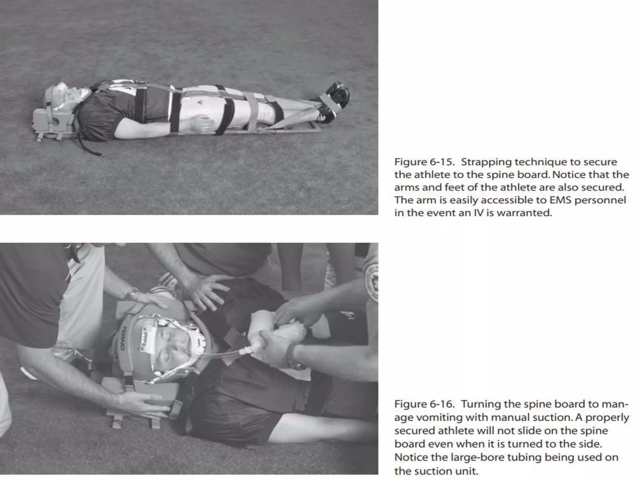 Chapter 6 cervical spine injuries | PPTX
