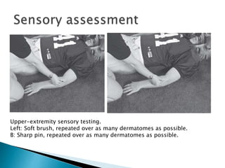 Chapter 6 cervical spine injuries | PPTX
