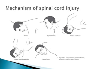 Chapter 6 cervical spine injuries | PPTX