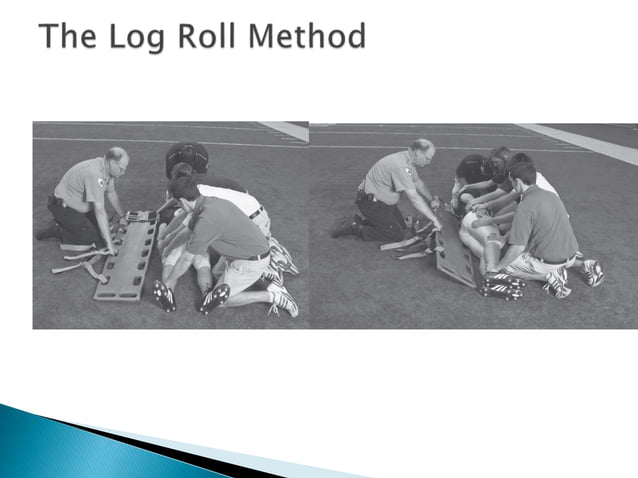 Chapter 6 cervical spine injuries | PPTX