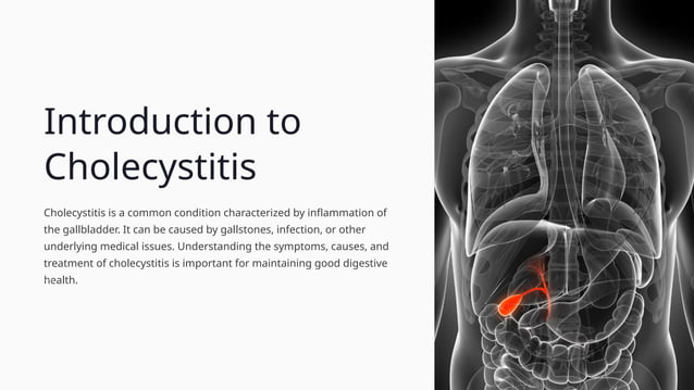 (Cholecystitis)CholecystitisCholecystitis.pptx