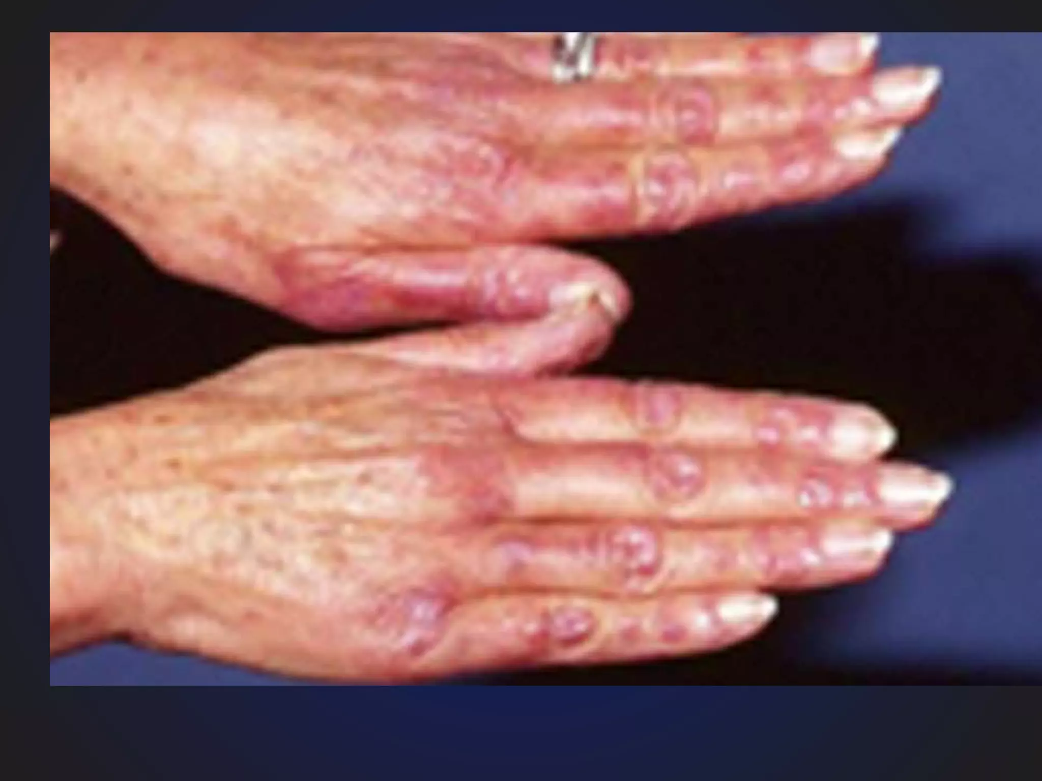 clinical aspects of neoplasia | PPTX