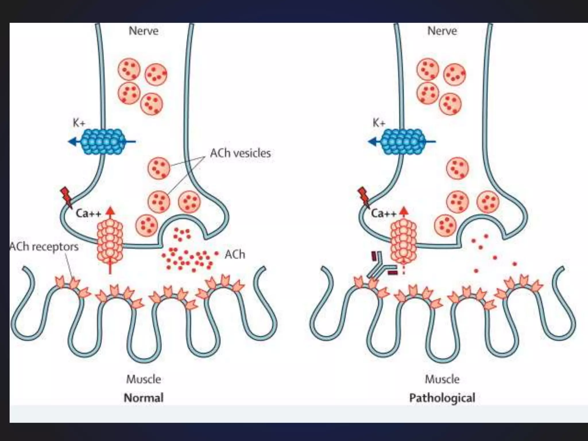 clinical aspects of neoplasia | PPTX