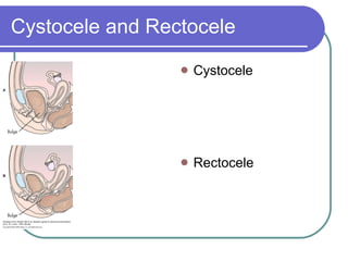 Common Disorders Of Male Female Reproductive Systems Ppt Sept 2006 | PPT