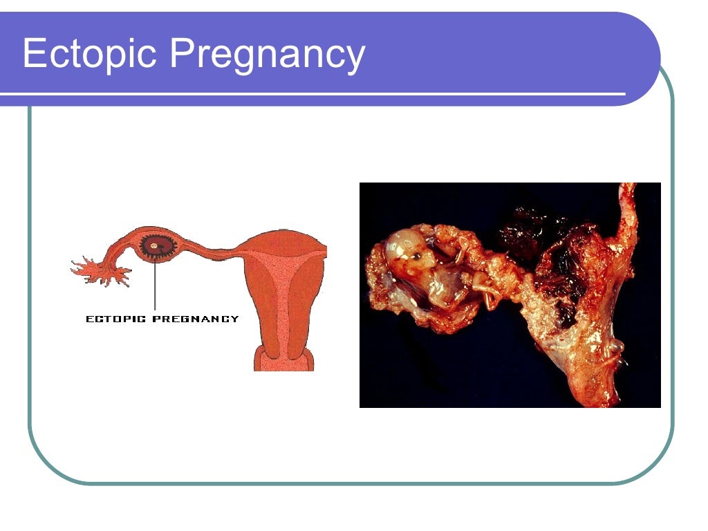 Common Disorders Of Male Female Reproductive Systems Ppt Sept 2006