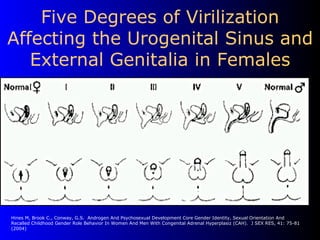 6 Congenital Adrenal Hyperplasia | PPT