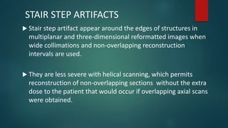 6 CT ARTIFACTS-Rohit.pptx