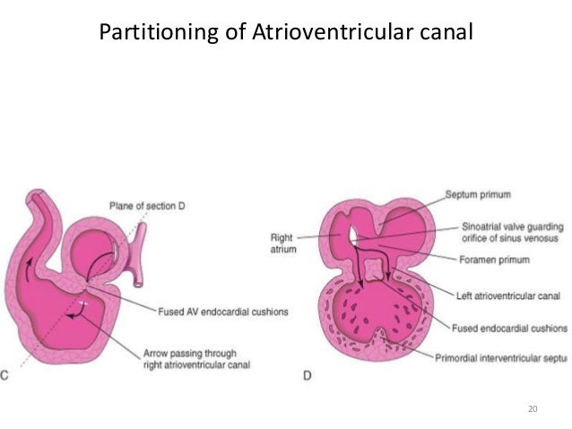 6 development of the heart akd