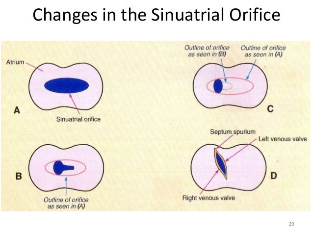 6 development of the heart akd